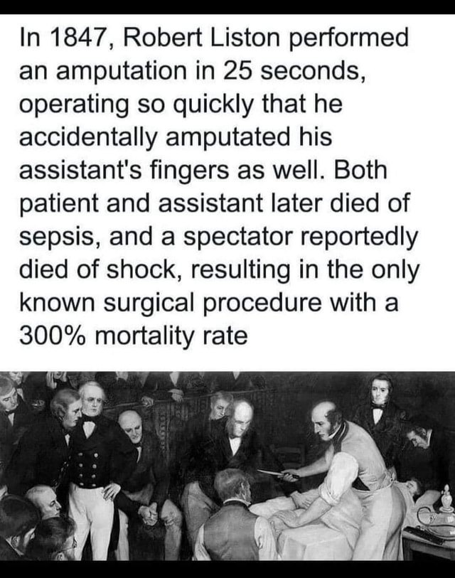 In 1847, Robert Liston performed an amputation in 25 seconds, operating ...
