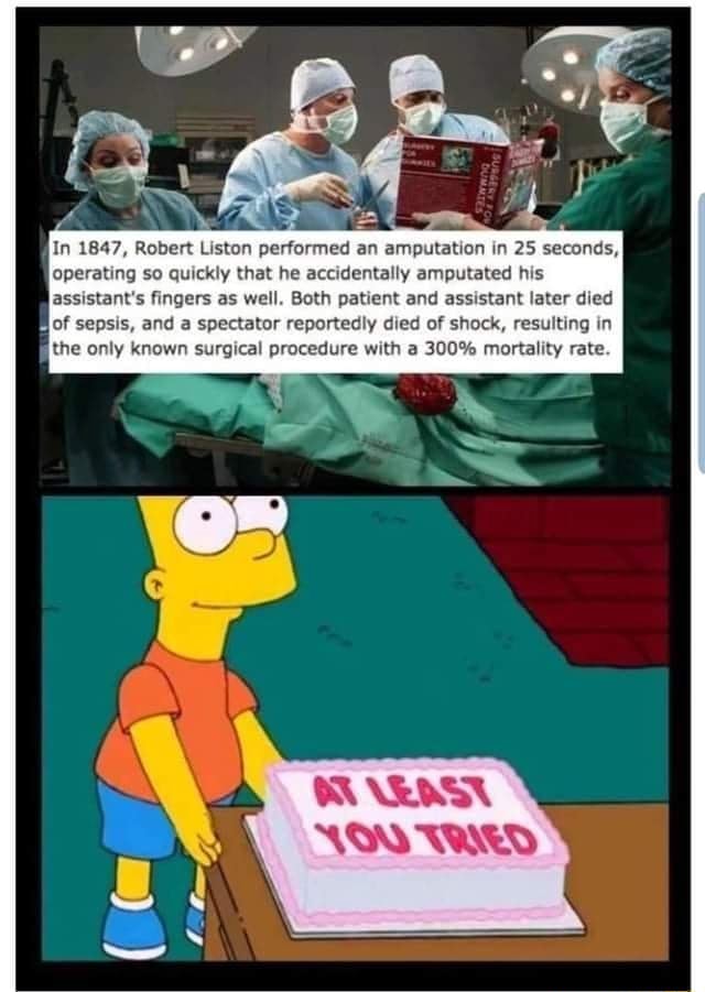 In 1847 Robert Liston Performed An Amputation In 25 Seconds Operating So Quickly That He