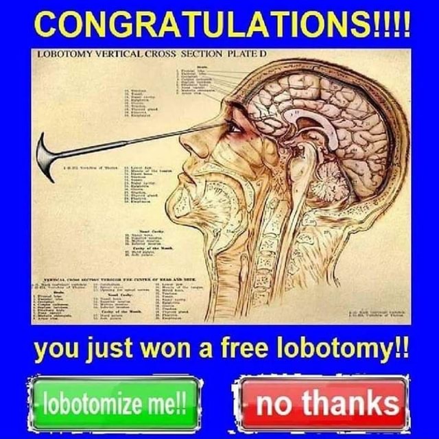 CONGRATULATIONS!!! SEETION you just won won a free lobotomy! ze mel ...