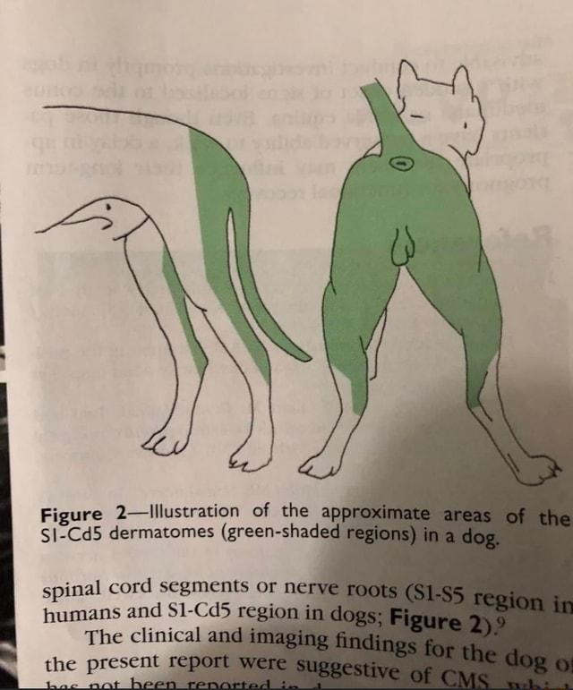 Figure 2-lllustration of the ap areas of the dermatomes (green-shaded ...