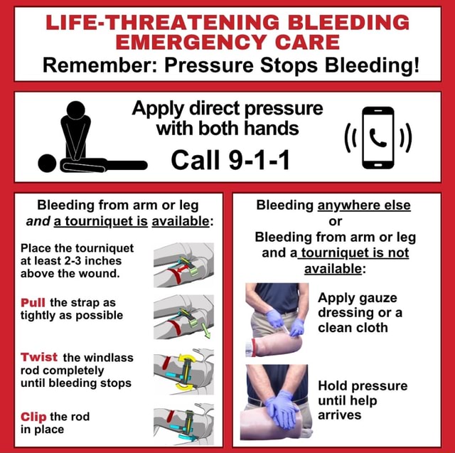 LIFE-THREATENING BLEEDING EMERGENCY CARE Remember: Pressure Stops ...