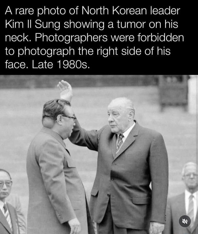A rare photo of North Korean leader Kim ll Sung showing a tumor on his ...