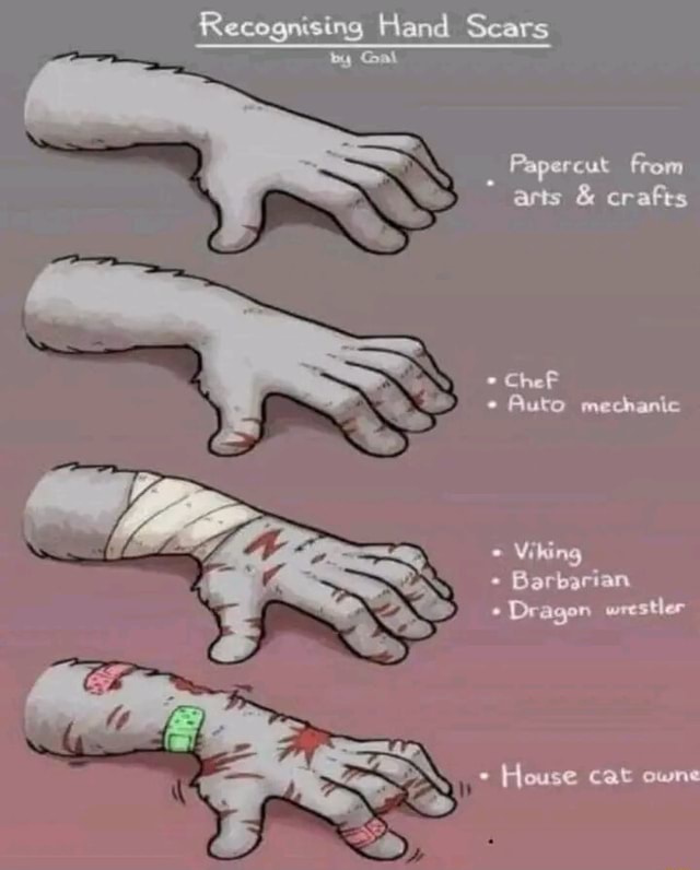 Recognising Hand Scars by Gal Papercut from arts & crafts Chef Ate ...