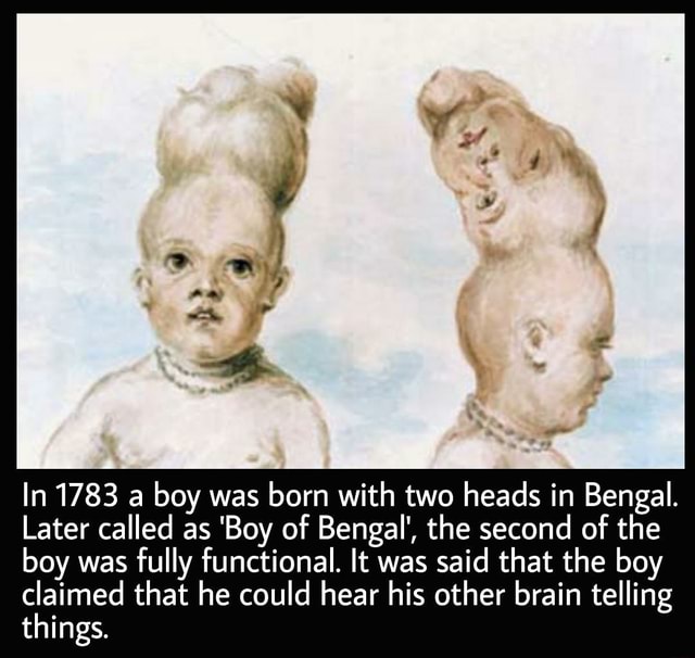 In 1783 a boy was born with two heads in Bengal. Later called as 'Boy ...