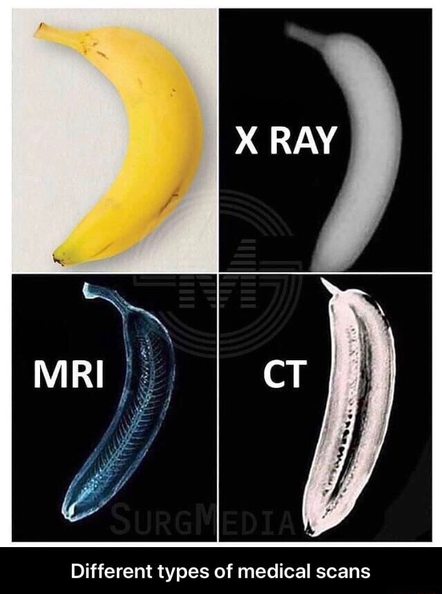 Different types of medical scans - Different types of medical scans ...