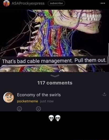 Asaprockyexpress (subseribe That's bad cable management. Pull them out ...