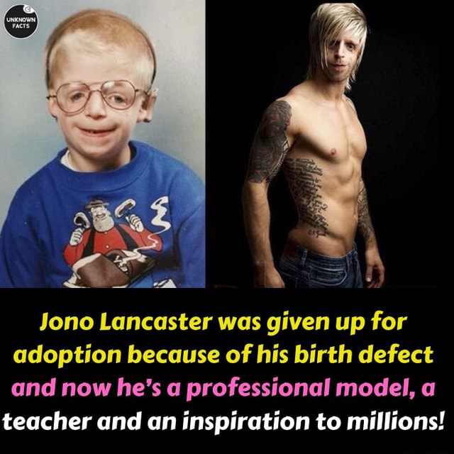 BS Jono Lancaster was given up for adoption because of his birth defect ...