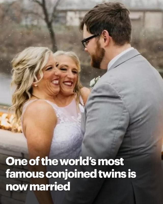 One of the world's most famous conjoined twins is now married - iFunny
