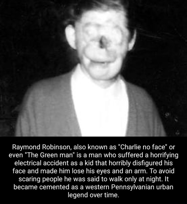 We Raymond Robinson, also known as "Charlie no face" or even "The Green ...