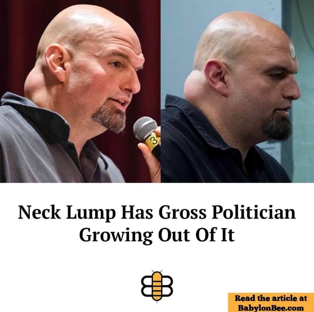 Neck Lump Has Gross Politician Growing Out Of It Read the article at ...