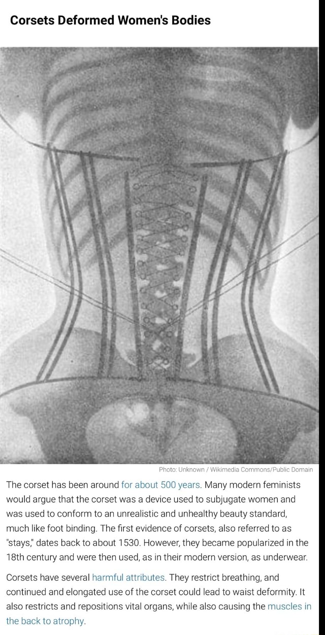 Corsets Deformed Women's Bodies Photo: Unkno\ Nikimedia Domain The ...