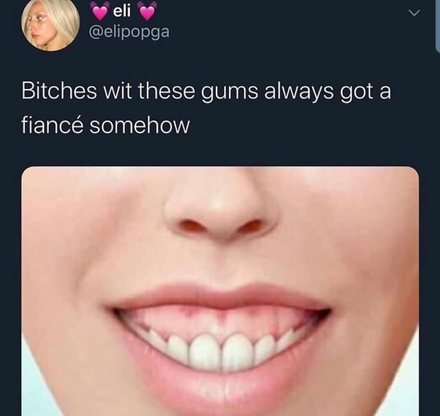 Bitches Wit these gums always got a fiancé somehow - iFunny