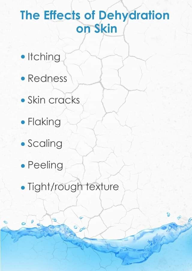 The Effects of Dehydration on Skin e liching e Redness Skin cracks e ...