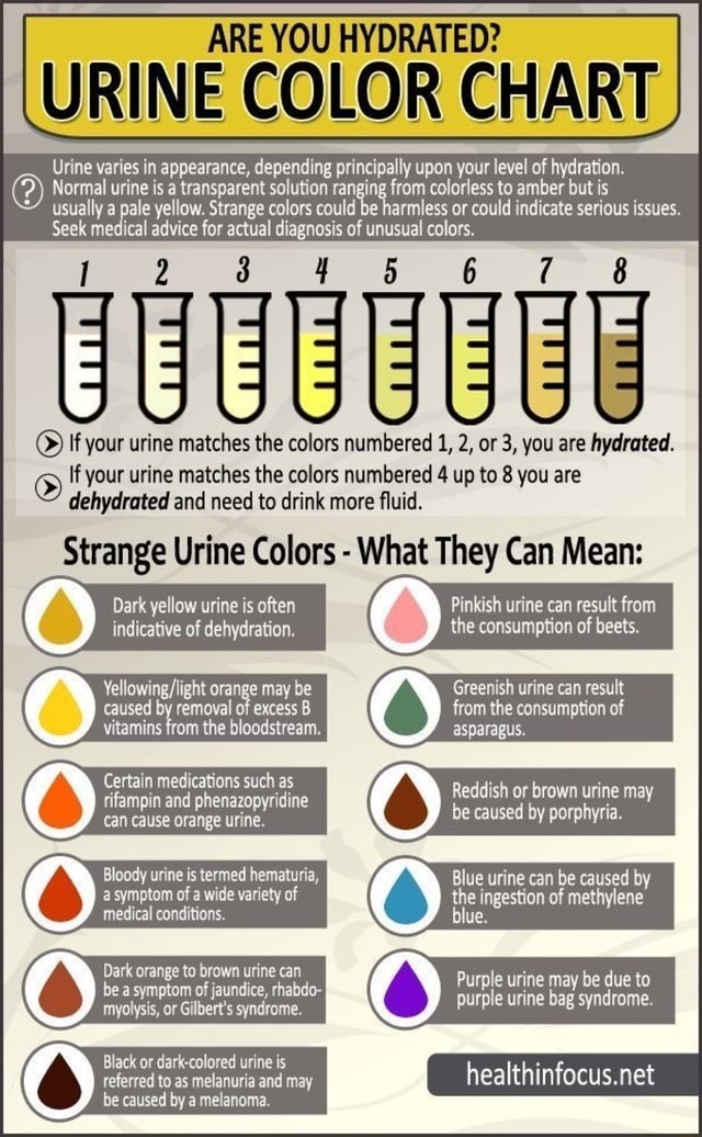 YOU URINE COLOR CHART Urine varies Normal urine is transparent solution ...