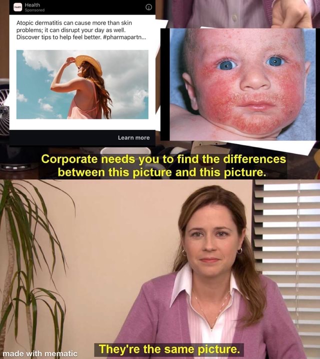 Health Atopic dermatitis can cause more than skin problems; it can ...
