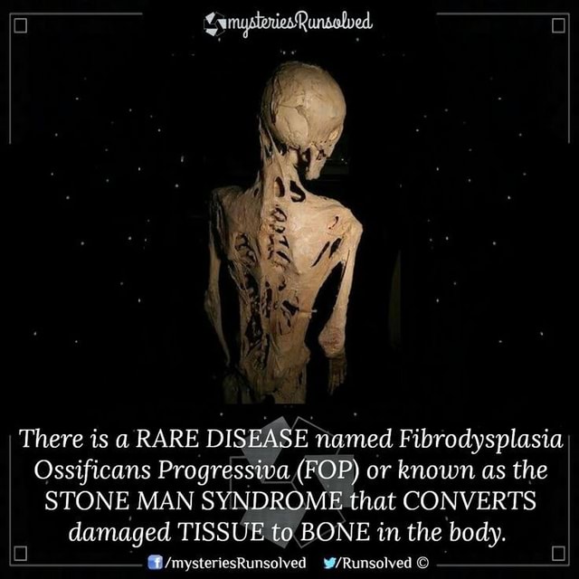 There is a RARE DISEASE named Fibrodysplasia Ossificans Progressiva ...