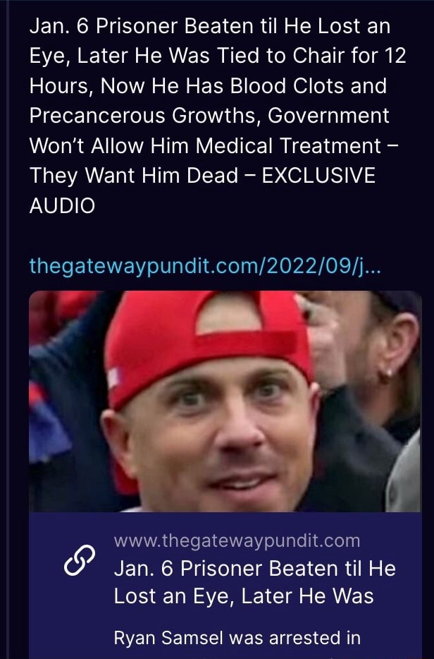Jan. 6 Prisoner Beaten til He Lost an Eye, Later He Was Tied to Chair ...