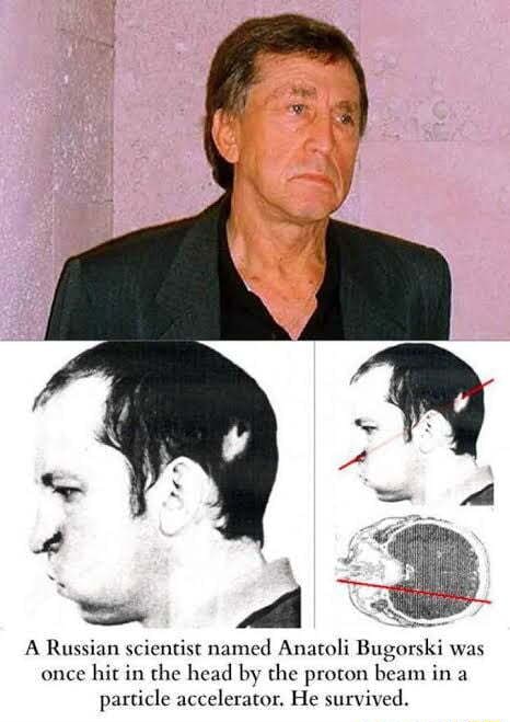 A Russian scientist named Anatoli Bugorski was once hit in the head by ...