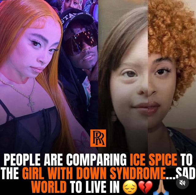 PEOPLE ARE COMPARING ICE SPICE TO THE GIRL WITH DOWN SYNDROME...SQD ...