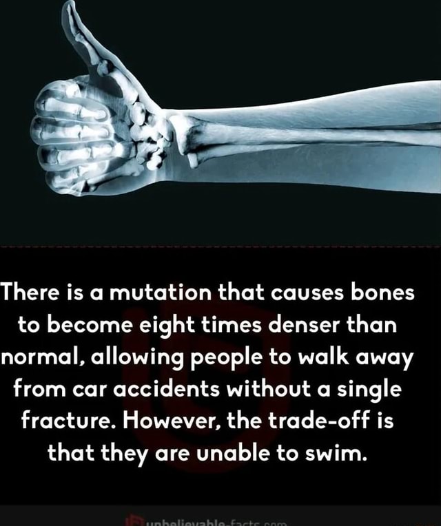 There is a mutation that causes bones to become eight times denser than ...