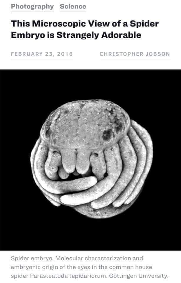 Phetography This Microscopic View of a Spider Embryo is Strangely ...