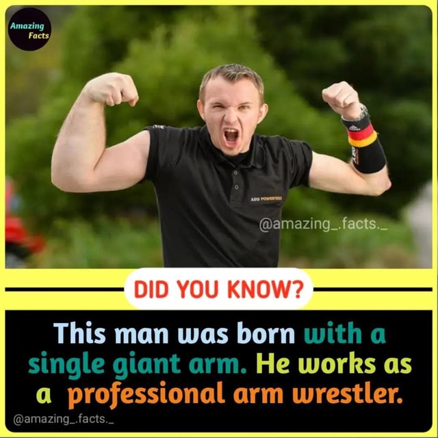 DID YOU KNOW? This man was born with single giant arm. He works as ...