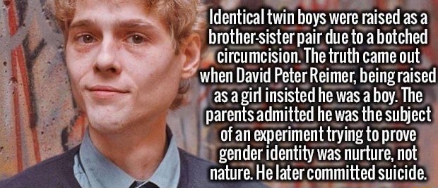 Af Identical twin boys were raised as a brother -sister pair due to a ...