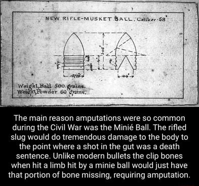 WEW RIFLE-MUSKET The main reason amputations were so common during the ...
