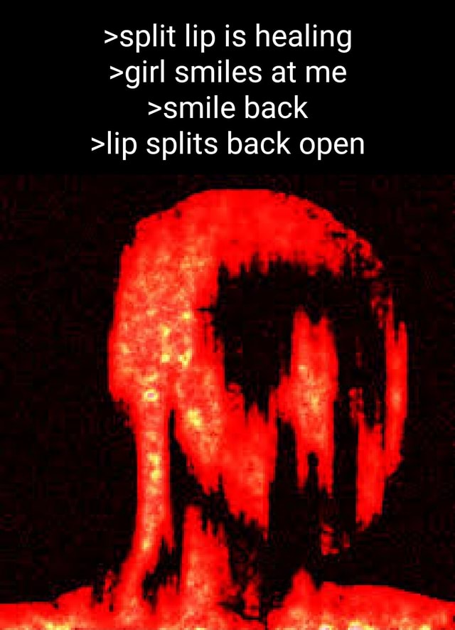 >split lip is healing >girl smiles at me >smile back >lip splits back ...
