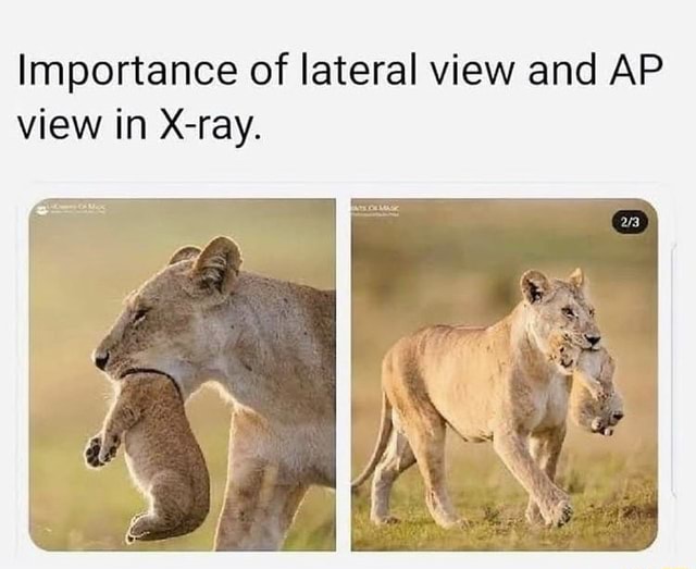 Importance of lateral view and AP view in X-ray. - iFunny