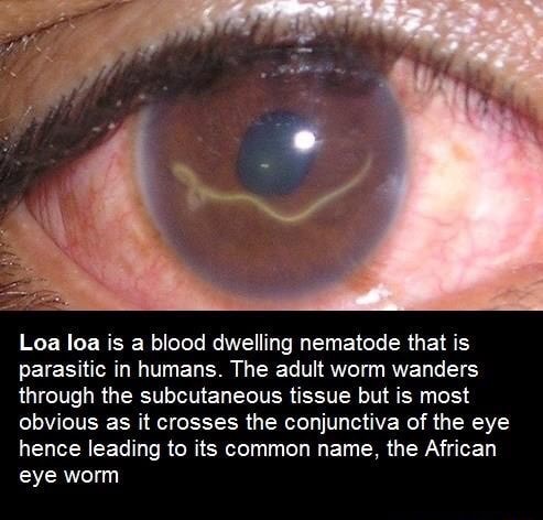 Loa loa is a blood dwelling nematode that is parasitic in humans. The ...