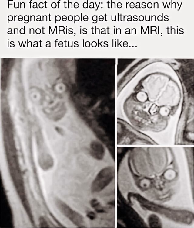 Fun fact of the day: the reason why pregnant people get ultrasounds and ...