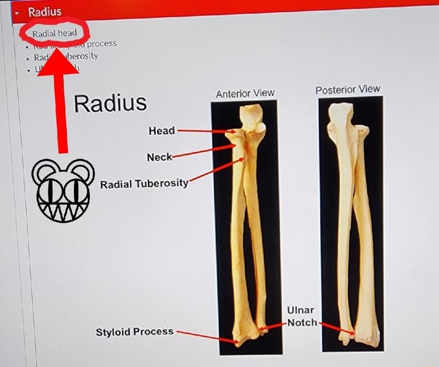 I Radius berosity 1 Anterior View Posterior View Radius Head Neck ...