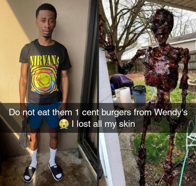 Do not eat them 1 cent burgers from Wendy's I lost all my skin WAY I ww ...