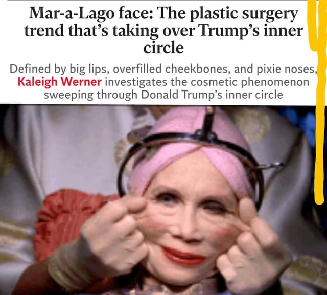 Mar-a-Lago face: The plastic surgery trend that's taking over Trump's ...