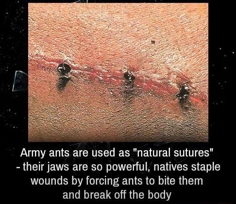 Army ants are used as "natural sutures' their jaws are so powerful ...
