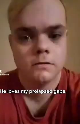 He loves ny prolapsed gar. - iFunny