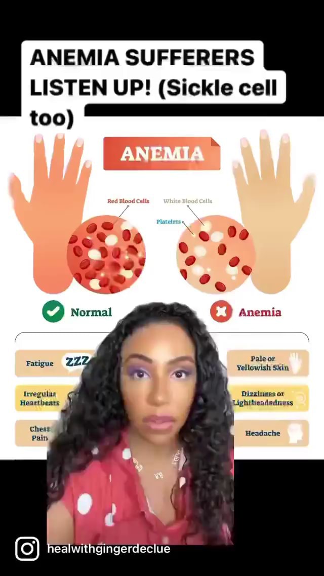 ANEMIA SUFFERERS LISTEN UP! (Sickle cell anemia Pale or Yellowish Skin ...