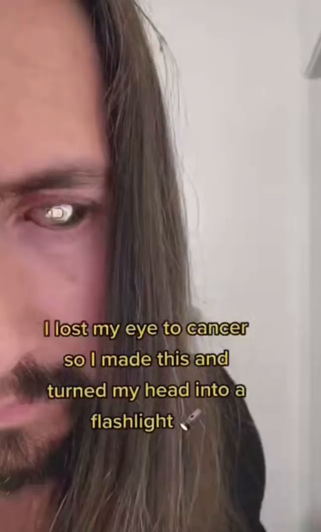 My eye made thisand turned my head into flashlight - iFunny