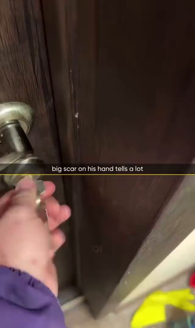 Big scar on his hand tells a lot - iFunny