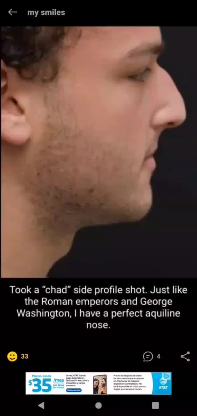 My smiles Took "chad" side profile shot. Just like the Roman emperors ...