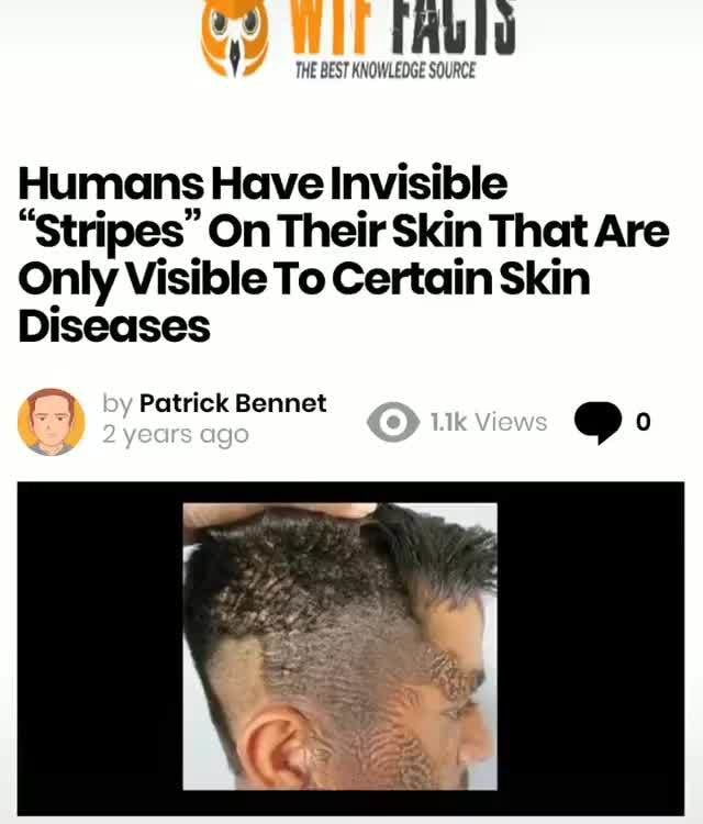 Humans Have Invisible “Stripes” On Their Skin That Are Only Visible To ...