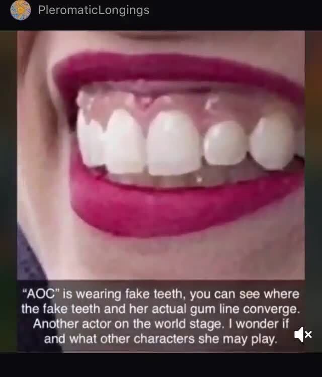 "AOC" is wearing fake teeth, you can see where the fake teeth and her ...