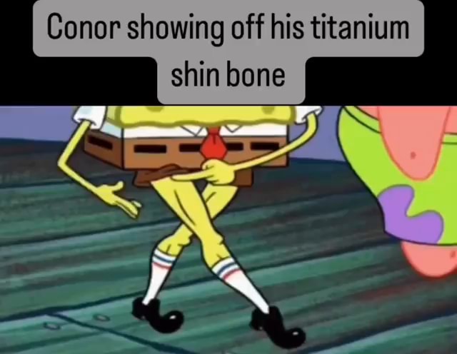 Conor showing off his titanium shin bone - iFunny