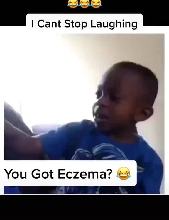 I Cant Stop Laughing You Got Eczema? © - iFunny