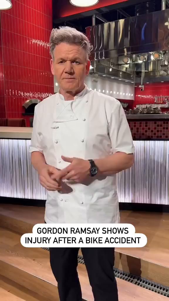 GORDON RAMSAY SHOWS INJURY AFTER A BIKE ACCIDENT - iFunny