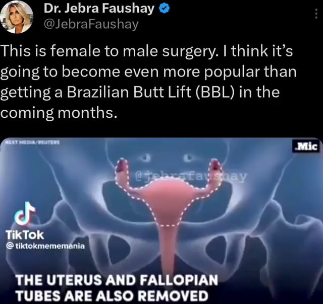Dr. Jebra Faushay @JebraFaushay This is female to male surgery. I think ...