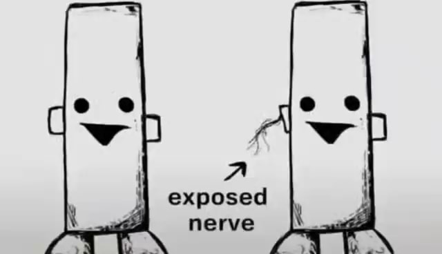Exposed nerve - iFunny