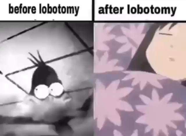 Before lobotomy after lobotomy - iFunny