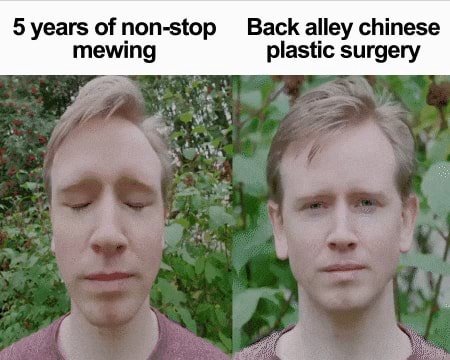 Years of non-stop Back alley chinese mewing plastic surgery - iFunny